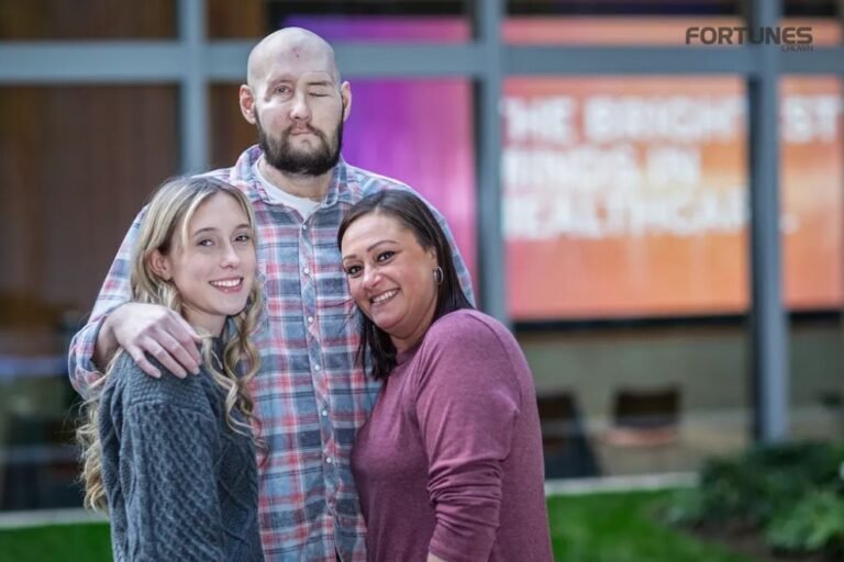 Aaron James: Pioneering Whole Eye Face Transplant Fortunes Crown